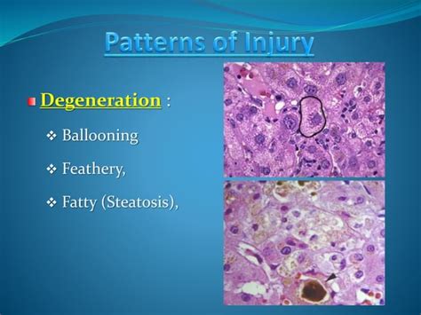 Liver Biopsy Interpretation Ppt