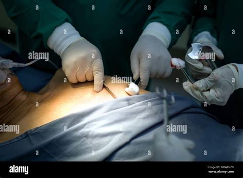 Hands Of Healthcare Professional Wearing Medical Glove Holding Scalpel