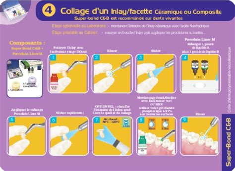 Inlay Core Ceramique Pdf Notice And Manuel D Utilisation