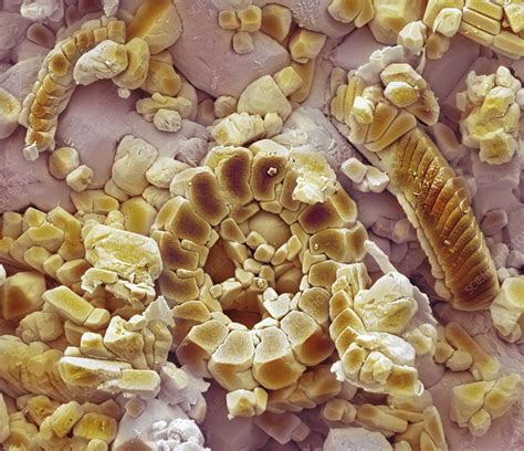 Fossil Debris In Chalk Sem Stock Image F003 4433 Science Photo