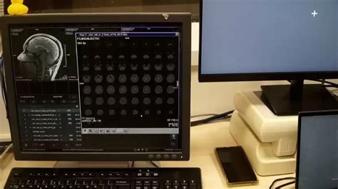 Chinese Scientists Achieve Breakthrough In Early D Ainave