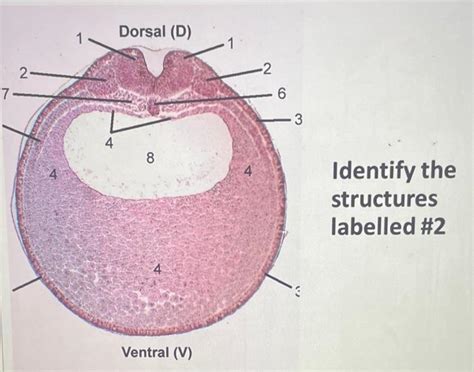 Solved Identify The Structures Labelled 2