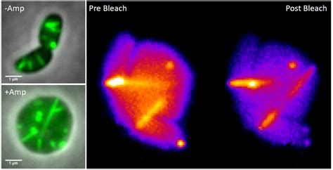 Size Matters Supersized Bacterial Secretion System Research Communities By Springer Nature