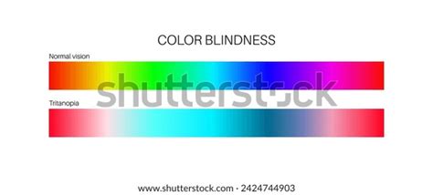 Tritanopia Vision Color Blindness Infographic Human Stock Vector Royalty Free 2424744903