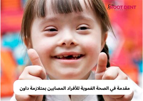 مقدمة في الصحة الفموية للأفراد المصابين بمتلازمة داون