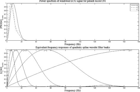Figure 1 From A Generic And Robust System For Automated Patient Specific Classification Of Ecg
