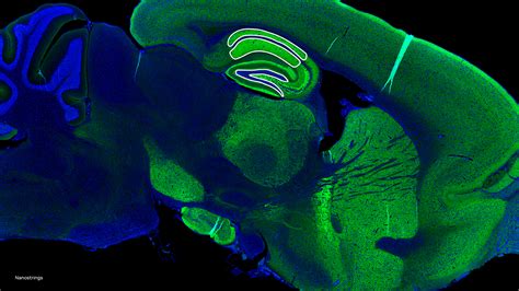 Shrink Genomics And Single Cell Analysis Time To Minutes With Nvidia Parabricks And Nvidia Ai