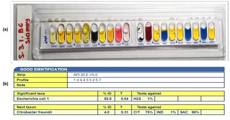 Biochemical Test Candidate Of Escherichia Coli Using Api 20e A And
