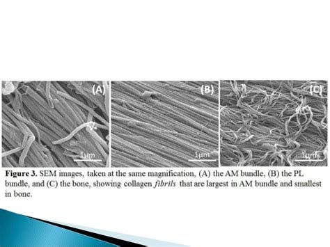 Acl Arthroscopic Reconstruction Single Bundle Vs Double Bundle
