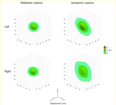 Covariance Structure Of Metabolic Lesions Global Dependency The