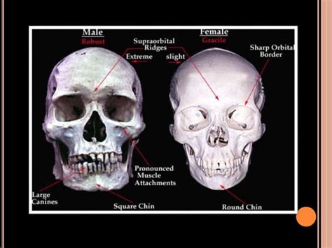 Sex Determination In Forensic Pptx