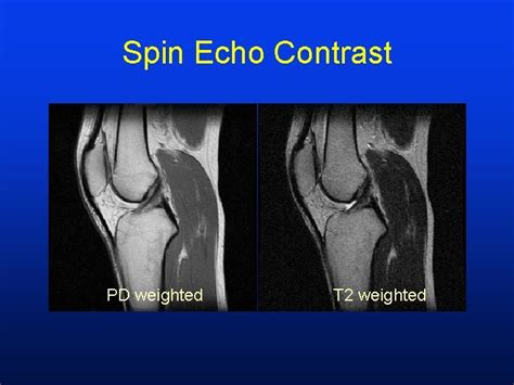 Imaging Sequences Part Ii Gradient Echo Spin Echo