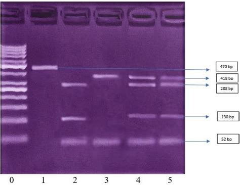 Pcr Rflp With Fastdigest Nlaiii Hin1ii Restriction Enzyme Lane 0 Download Scientific Diagram