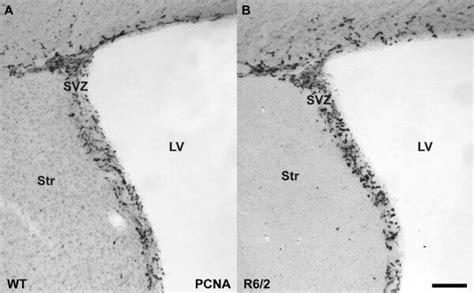 Cell Proliferation In The Subventricular Zone Of The R62 Hd Animals Is