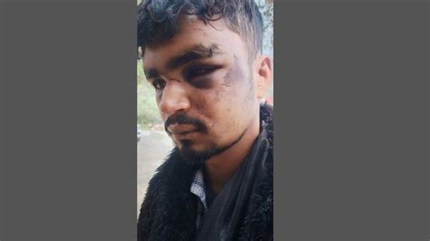 Singrauli Crime News ट्रान्सपोर्टर व उसके गुर्गों ने युवक का अपहरण कर