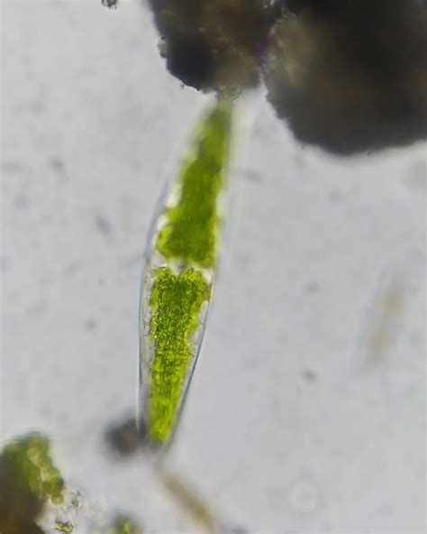 Closterium Spp 400x Magnification R Microscopy