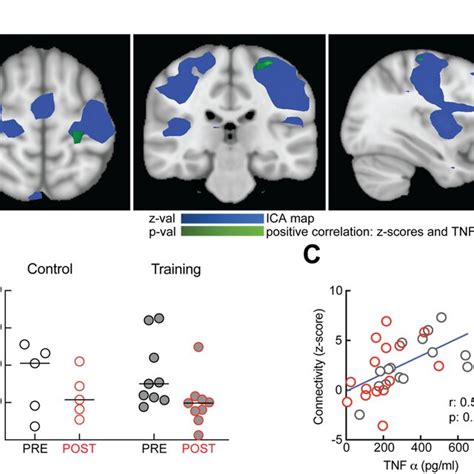 Correlation Between Tnfα And Connectivity In The Sensorimotor Network