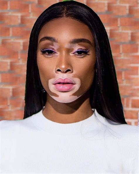 Winnie Harlow A Modelo Que Revolucionou A Beleza Com O Seu Vitiligo