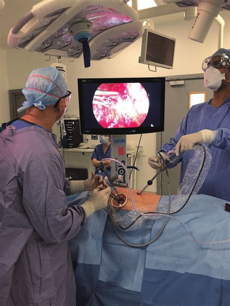 Operating Room Setting In A Typical Case Of Lower Lobe Segmentectomy