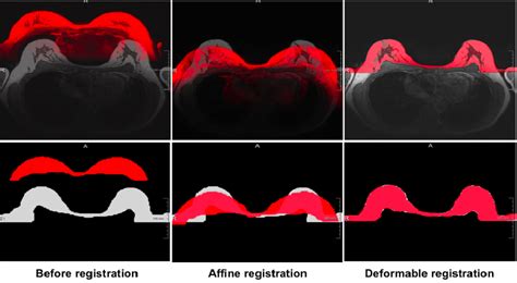 illustration of affine transform and deformable registration current