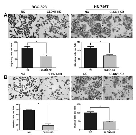 Knockdown Of Cldn1 Inhibits Cell Migration And Invasion In Vitro A