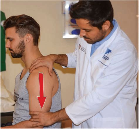 Sulcus Sign With The Patient Seated The Examiner Grasps The Affected