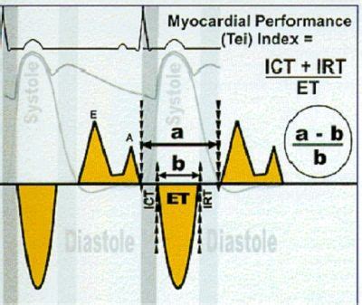 Myocardial Performance Index MPI In Cardiology
