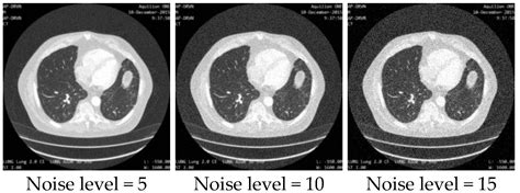 Sensors Free Full Text Computed Tomography CT Image Quality Enhancement Via A Uniform