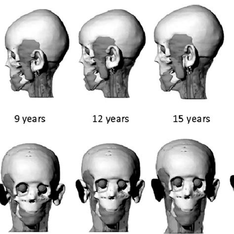 Standard Head Dimensions Cm For Five Different Ages Provided From The