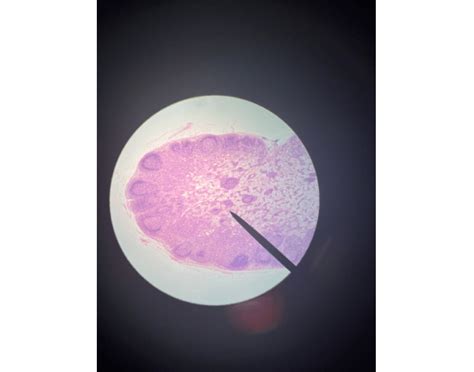 Lymph Node Microscopy Quiz