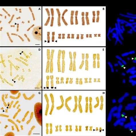 Silver Staining And Fish With Rdna On Metaphase Chromosomes From B