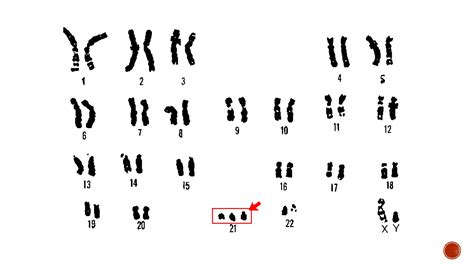 Genetic Disorders Pptx