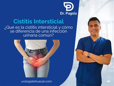 Cistitis Intersticial Urología Tehuacán
