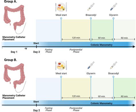 High Amplitude Propagated Contractions With Glycerin Versus Bisacodyl