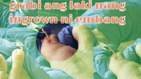 Pampering My Manager Todayher Ingrown So Big Youtube