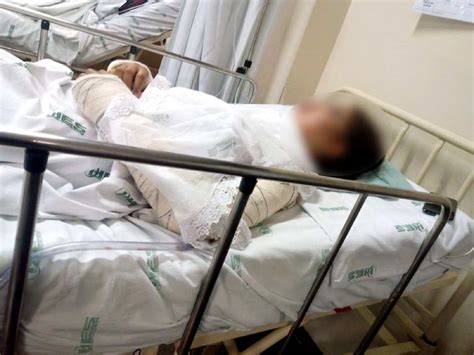 Grávida é agredida por mulheres barras de ferro e perde bebê