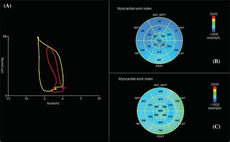 Pre‐positioning And During Ecmo And Iabp Support Pressurestrain Loops