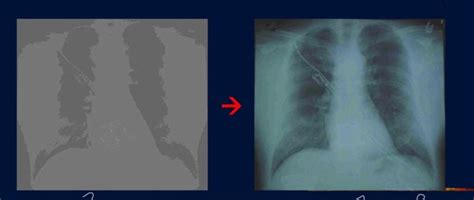 Digital Chapter 6 Rescaling Processing The Digital Image Flashcards Quizlet