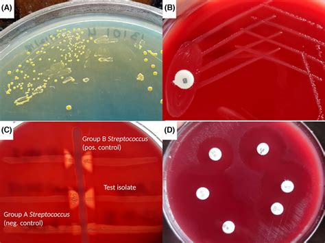 Group B Streptococcus Isolate Showing A Tiny Yellow Opaque Colonies