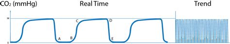 What Is Capnography Indications Uses And Interpretations Holistic