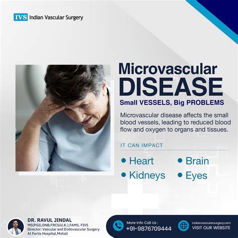 Dr Ravul Jindal Vascular And Endovascular Surgeon Microvascular