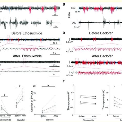 Pv Archt Mice Exhibited An Absence Seizure Phenotype Cortical Eeg And