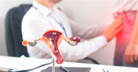 ¿qué Son Los Fibromas Uterinos Centro Médico San Pablo Ginecología