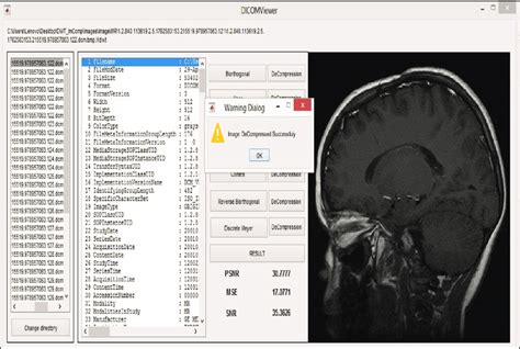 Graphical User Interface Of Dicom Image Download Scientific Diagram