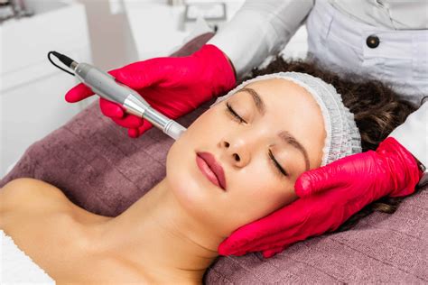 Microneedling For Stretch Marks Does It Work