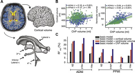 Choroid Plexus Volume Is Associated With Levels Of Csf Proteins Relevance For Alzheimers And