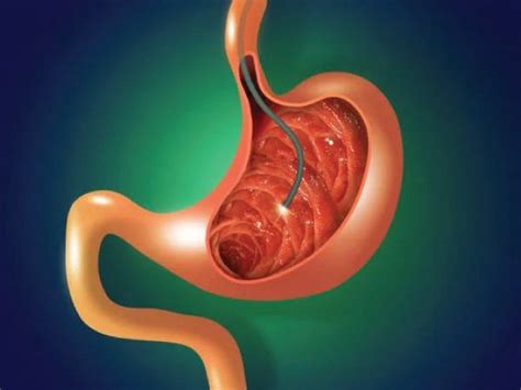 Advanced Endoscopy Services At Crest Surgical Practice