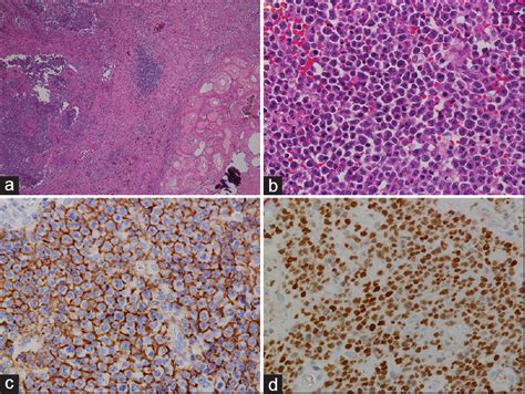Surgical Neurology International