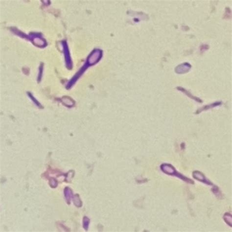 Gram Stain From A Wound Swab Rmicrobiology