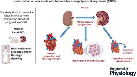 Arpkd Prognosis